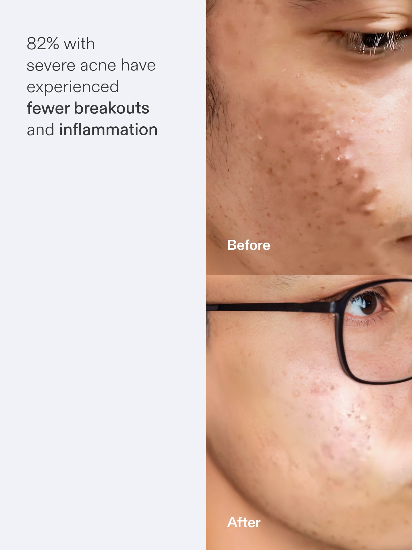 Buy PRAVENTAC™ | Onecare